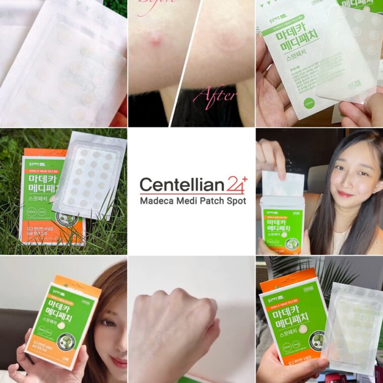 Centellian24 Parches «Madeca Medi Patch Spot» – 33 Patches – Kosmeticos